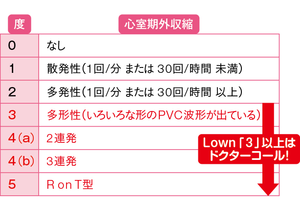 【図解付き】心室期外収縮（PVC/VPC）の心電図波形の特徴は？読み方の要点を解説 | エキスパートナースweb